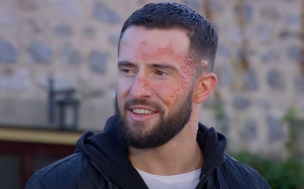 Exploring Ross Barton's complex family and departure from Emmerdale