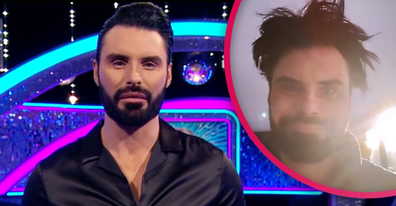 Rylan Clark unveils 'swollen' face as he issues update on his new teeth