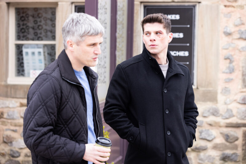 Emmerdale star Lewis Cope on future after Nicky attacked Caleb