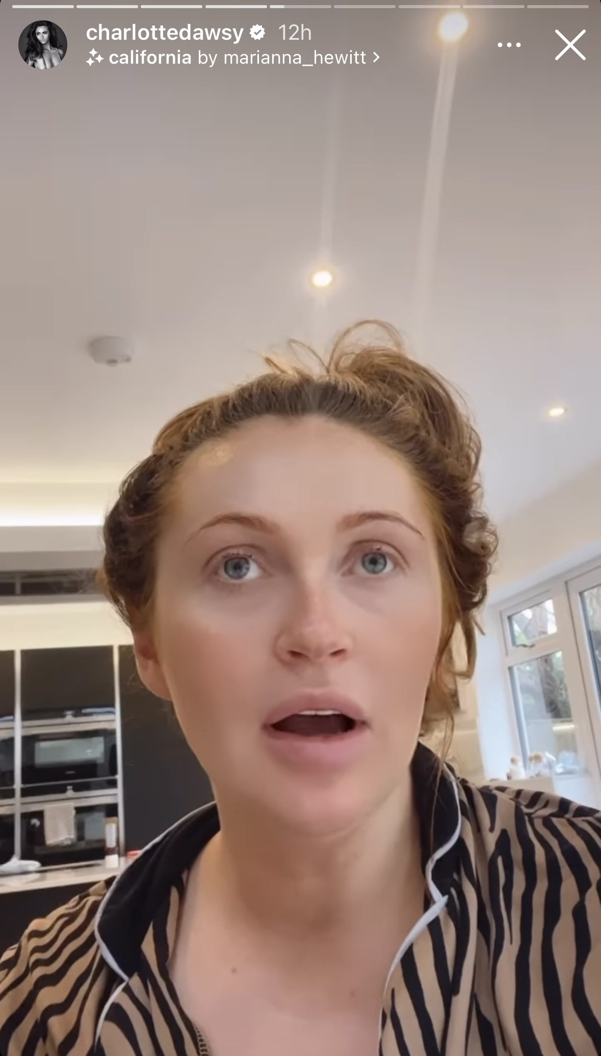 Charlotte Dawson says Instagram trolls report her to social services