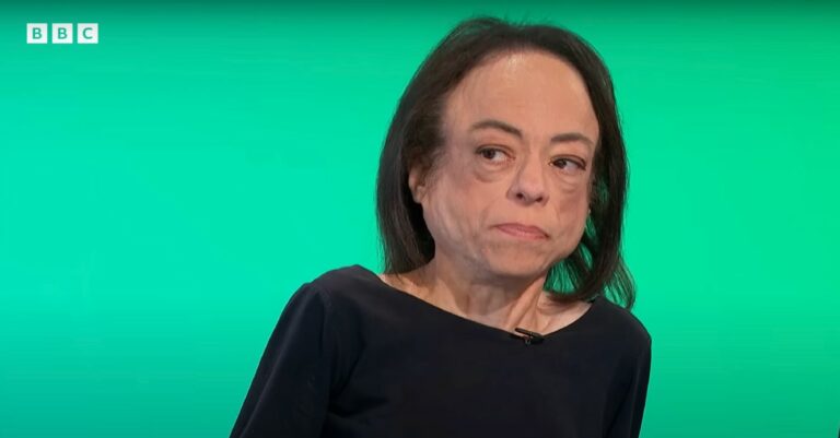 Silent Witness star Liz Carr admits she 'resented' show before quitting