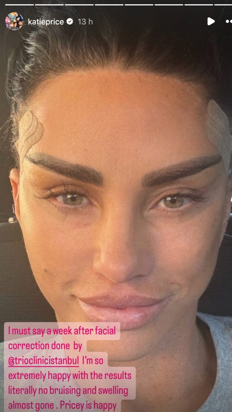 Katie Price latest: Inside Katie's changing appearance