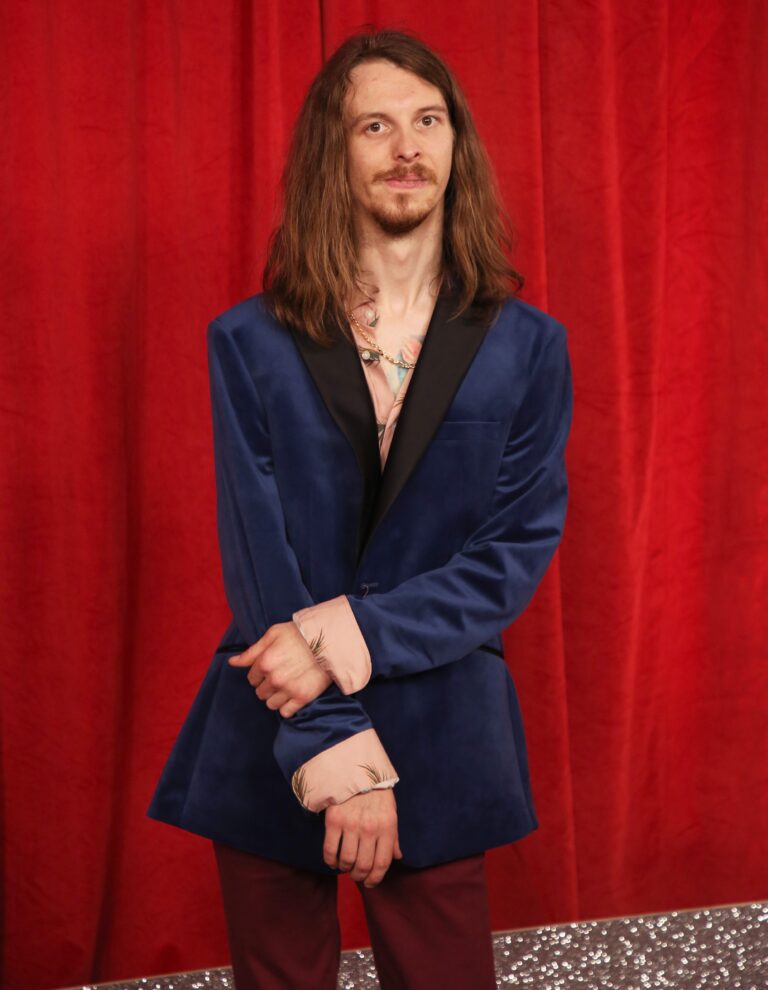 Emmerdale star James Moore marries his partner as she admits 'his ...